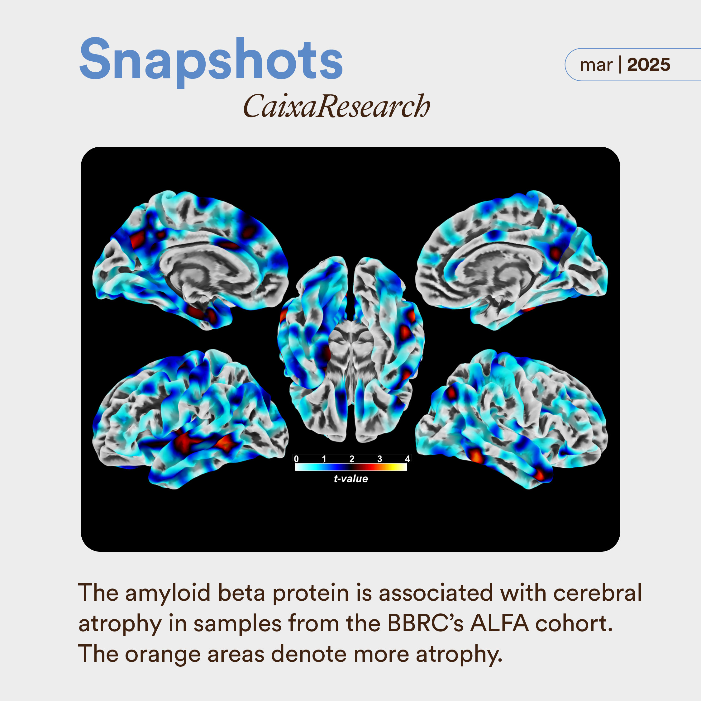 CaixaResearch Snapshot: Amyloid beta, a key factor as from the early ...
